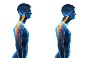 Forward-Head-Posture-(test-neck)-Align-Chiropractic-And-Wellness